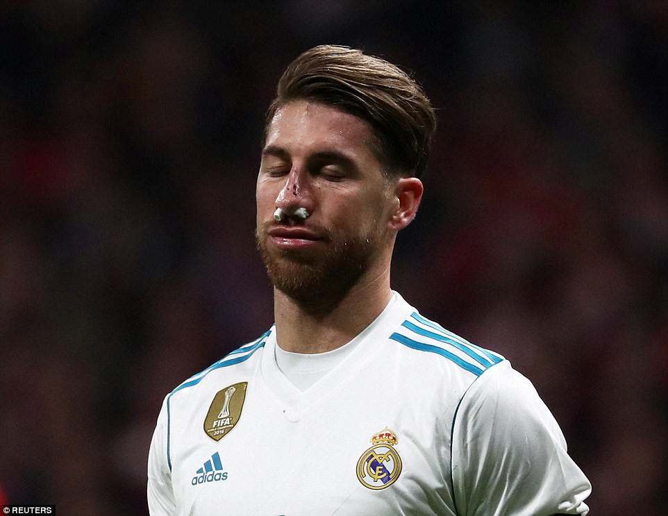 Đội trưởng Ramos vỡ mũi trong trận derby thành Madrid