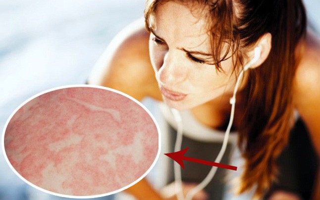 FDEIA, tin tức Mới nhất Giải mã hội chứng siêu hiếm khiến 2% dân số bị ...