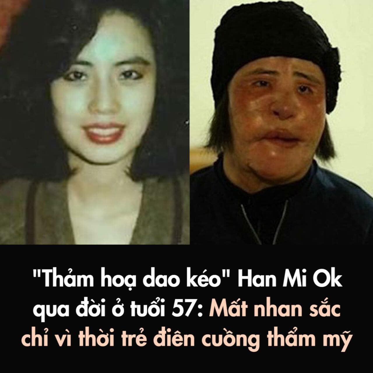 "Thảm hoạ dao kéo" Han Mi Ok qua đời ở tuổi 57: Mất nhan sắc chỉ vì ...