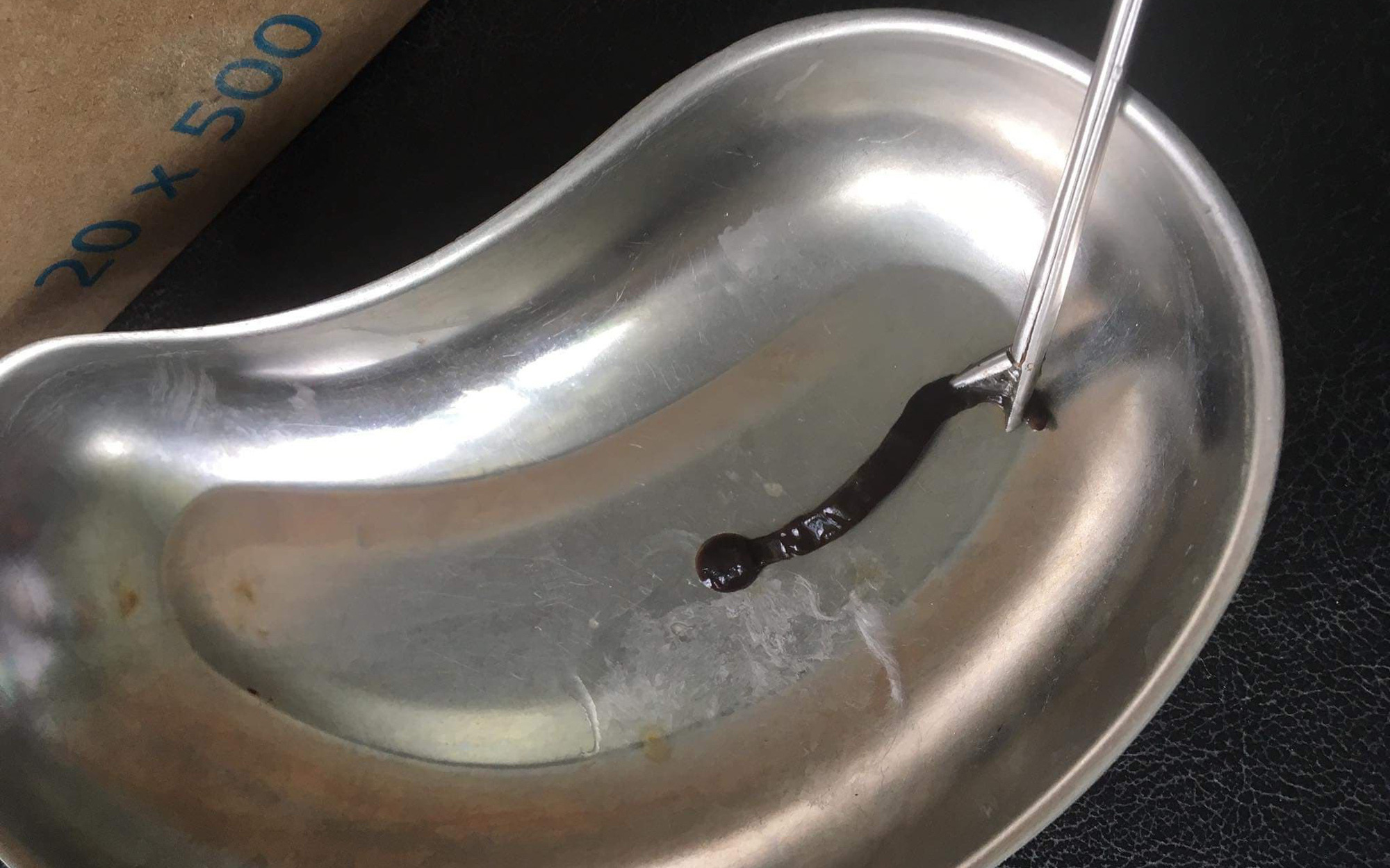 CON ĐỈA TRONG MŨI CHÁU BÉ, tin tức Mới nhất Kinh hoàng con đỉa dài 4 cm ...