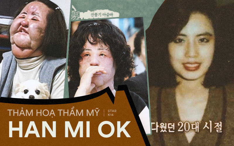 HAN MI OK, tin tức Mới nhất Xót xa "thảm hoạ dao kéo" Han Mi Ok: Mỹ ...