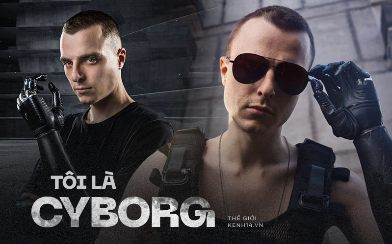 CYBORG, tin tức Mới nhất "Tôi là một cyborg": Câu chuyện về chàng trai ...