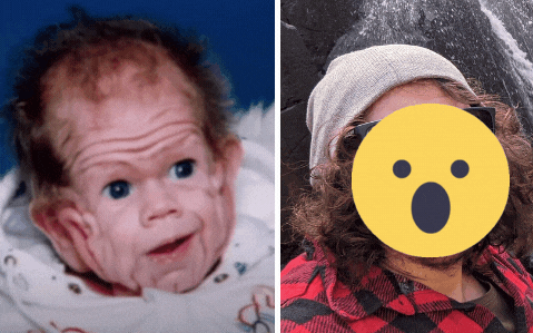 TOMM TENNENT, tin tức Mới nhất Cậu bé sinh ra toàn thân nhăn nheo khiến ...