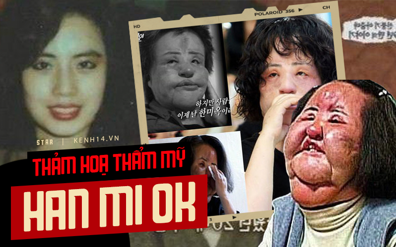 HAN MI OK, tin tức Mới nhất Cuộc đời khổ đau của "thảm hoạ thẩm mỹ" Han ...