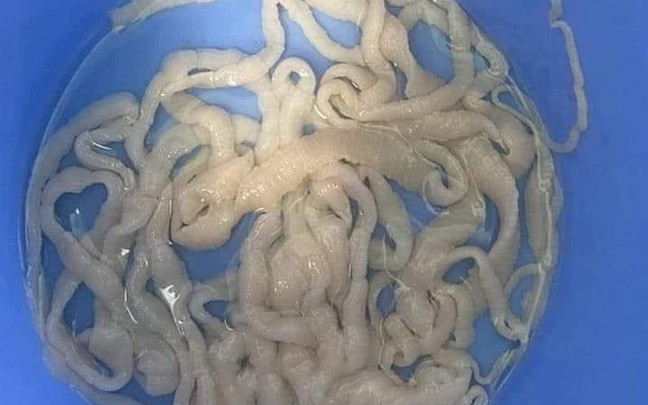 SÁN XƠ MÍT DÀI 10M, tin tức Mới nhất Quảng Nam: Sán xơ mít dài 10m được ...