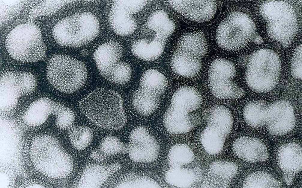 Virus CÚm Ah5 Tin Tức Mới Nhất Virus Cúm Ah5 Gây Tỷ Lệ Biến Chứng Và Tử Vong Cao Đọc Tin 