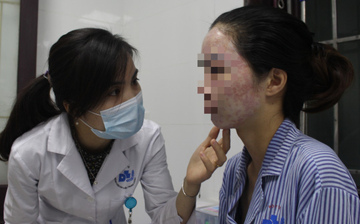 KEM DETOX DA, tin tức Mới nhất Sốt cao, chảy mủ da mặt sau khi bôi kem ...