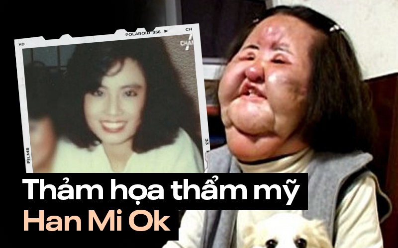 HAN MI OK, tin tức Mới nhất "Thảm họa thẩm mỹ" xứ Hàn: Nữ ca sĩ 17 lần ...