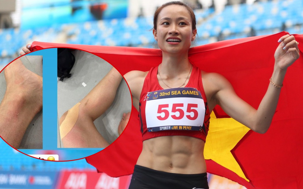 HUỲNH THỊ MỸ TIÊN, tin tức Mới nhất Hotgirl 6 múi điền kinh để lộ đôi chân trầy xước sau khi ...