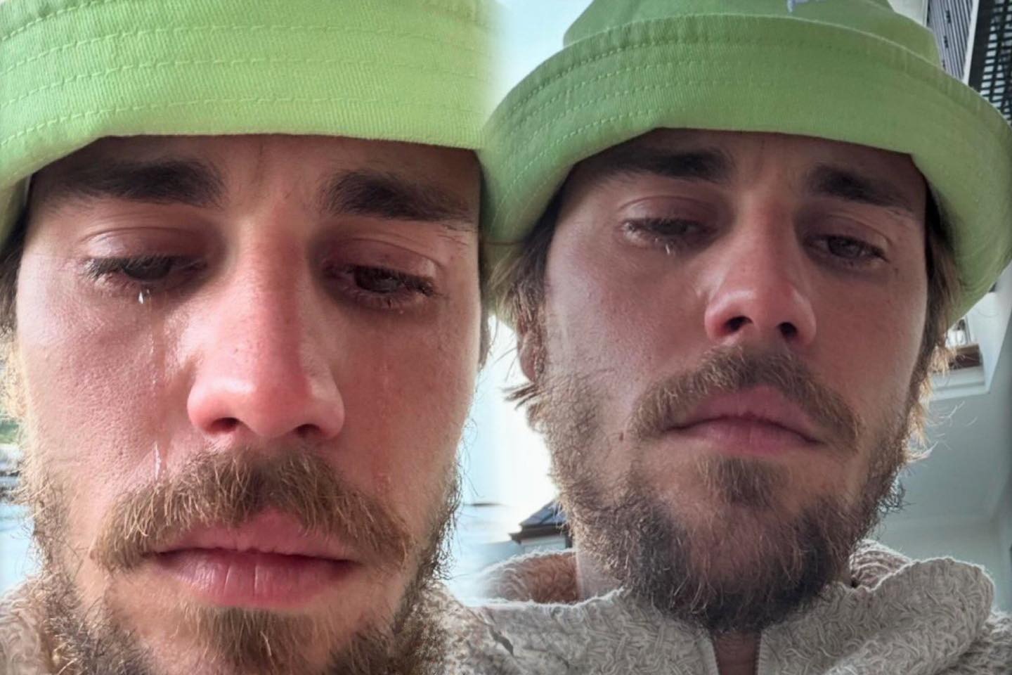 Justin Bieber bỗng đăng ảnh giàn giụa nước mắt rồi xóa đi, nghi vấn ly ...