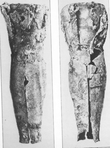 Tìm thấy bộ phận cơ thể giả đầu tiên trên thế giới