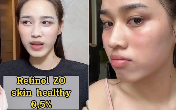 Cách sử dụng cách dùng retinol võ hà linh để có làn da mịn màng