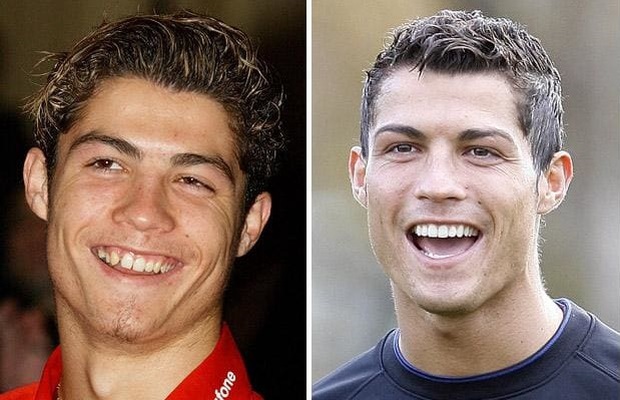 Ronaldo ngày càng đẹp trai nhờ phẫu thuật thẩm mỹ