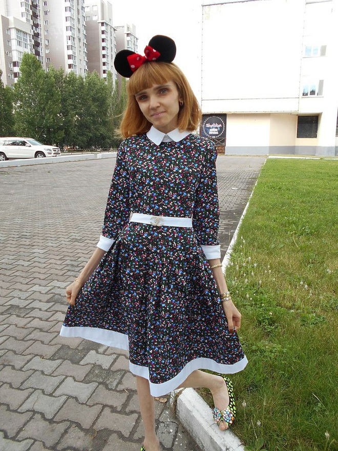 Cô gái da bọc xương nặng vỏn vẹn 17kg từng bị ví như "xác chết trong ...