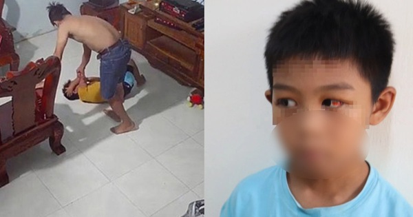 Vụ Cha Dượng đánh Con Riêng Của Vợ Cũ Người Mẹ Phản ứng Thế Nào Khi Con Bị đánh