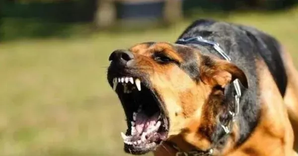 Bé trai 2 tuổi bị chó cắn lộ xương sọ