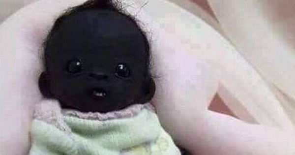 Em bé "đen nhất thế giới" gây sốt cộng đồng mạng