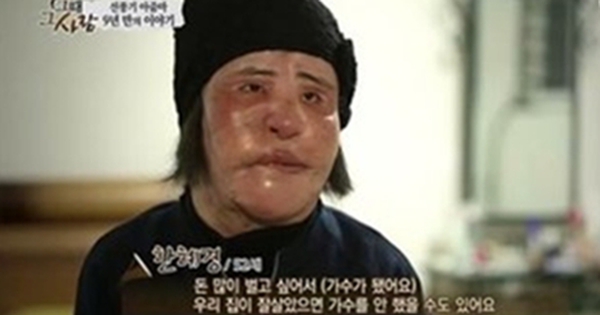 Cuộc sống cô đơn của "Thảm họa thẩm mỹ" Han Mi Ok