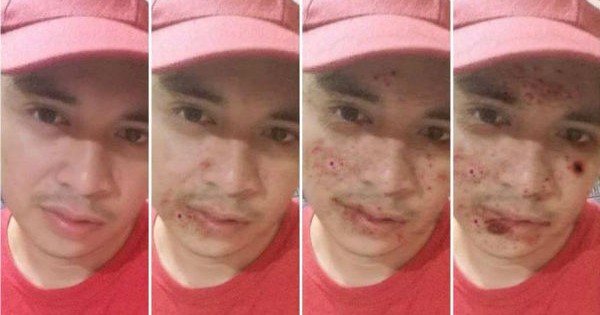 Ice Effex: Ứng dụng cảnh báo hậu quả cho các con nghiện "đập đá"