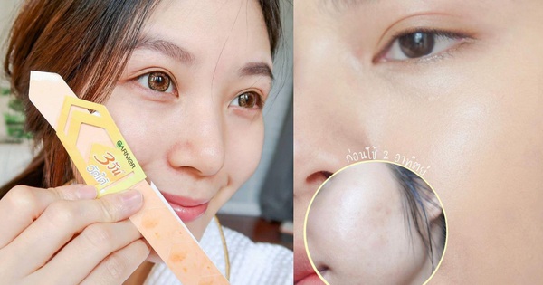 Thêm 1 loại serum Vitamin C hot hit, sáng mịn da an toàn chỉ sau 7 - 14 ...